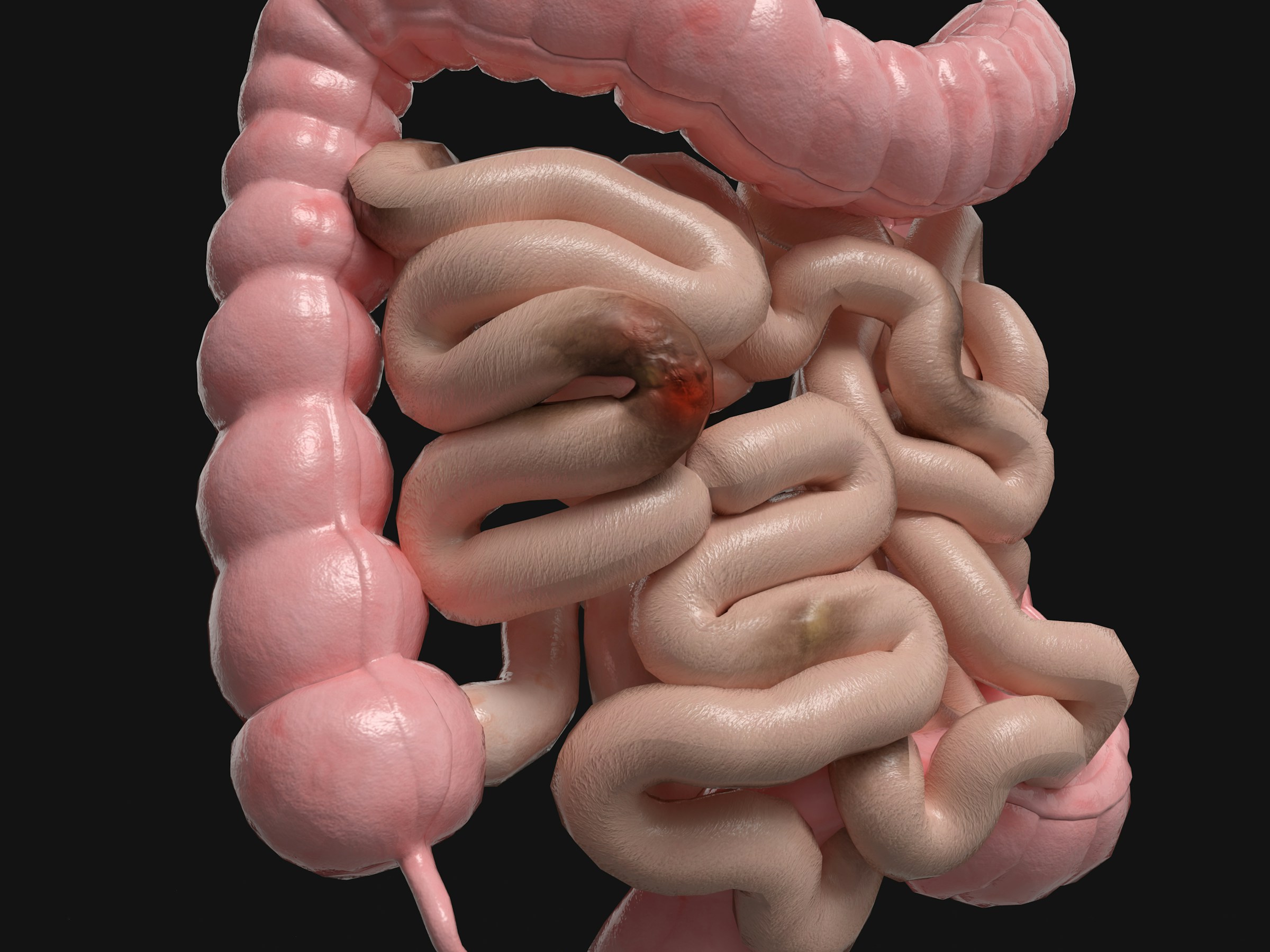 Panel Gastro - szybka diagnostyka biegunki i infekcji jelitowych metodą ...